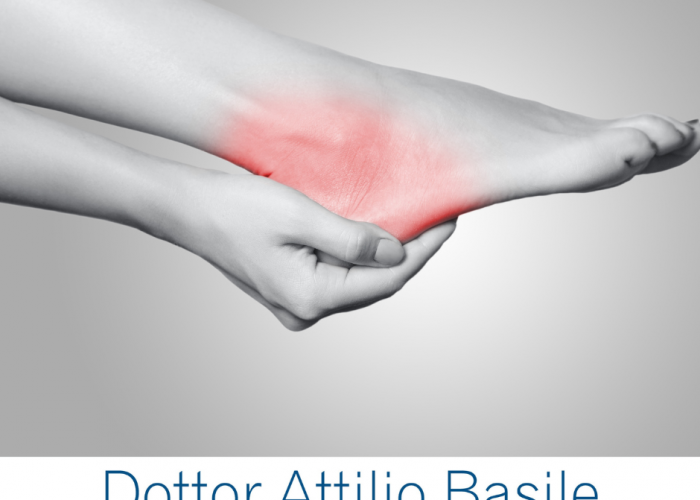 Lesione Osteocondrale caviglia rimedi - Dr Attilio Basile